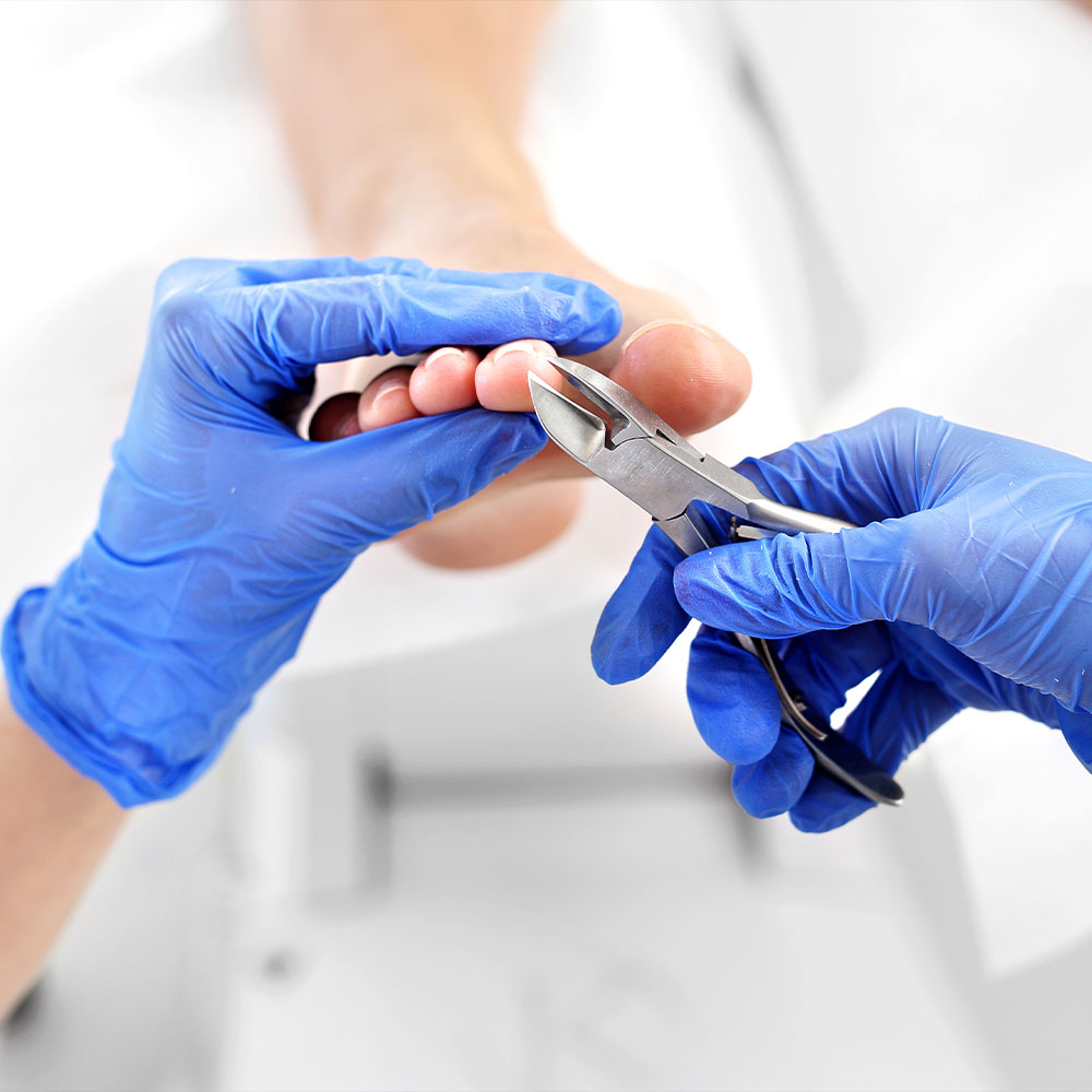 Nail cutting and Filing Banbury | WB footcare